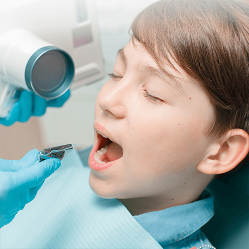 Kids Dental Crowns Fort Mill | GoKids Pediatric Dentistry