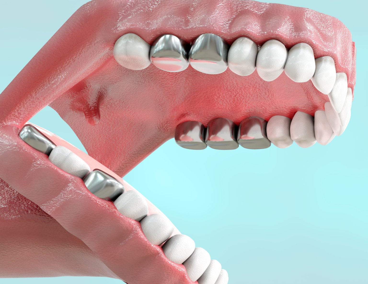 White Crowns Vs. Stainless Steel: Best Choice For Your Child